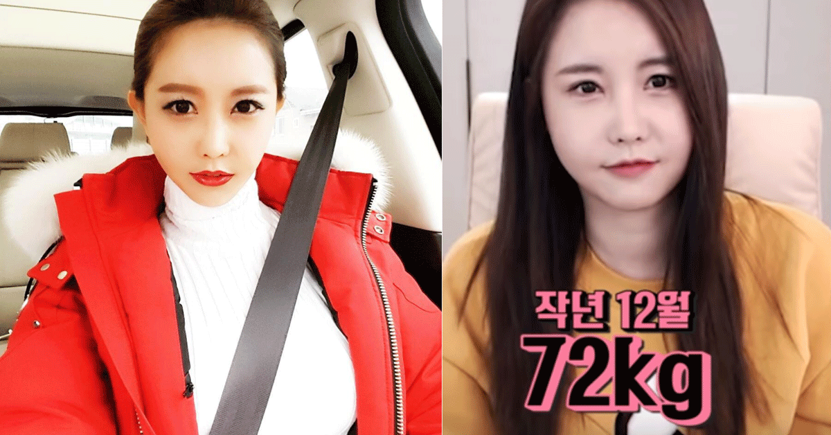 신장 이식 수술 뒤 47kg에서 72kg까지 찐 BJ윰댕 근황