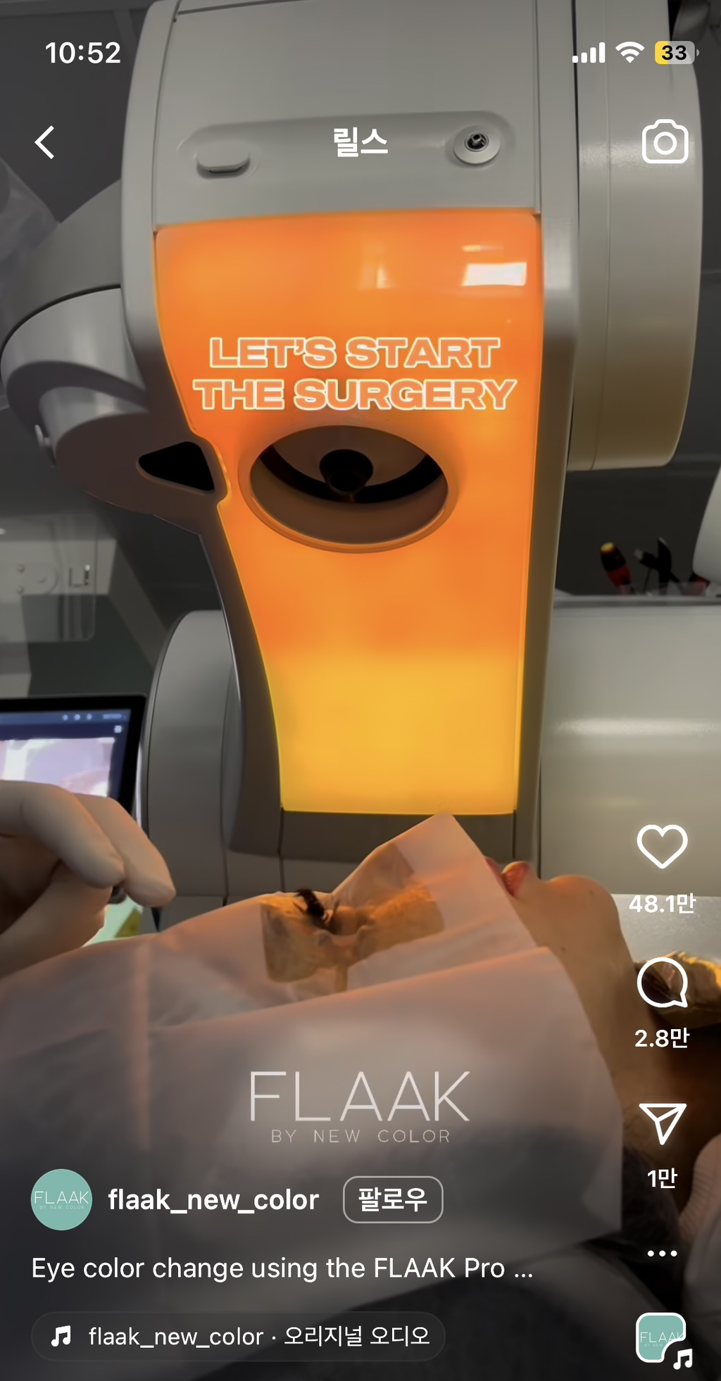 눈동자 타투 - 악플달면 쩌리쩌려버려 - ＊여성시대＊ 차분한 20대들의 알흠다운 공간