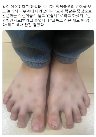 더쿠 - 여름철 유행한다는 급성 피부병.jpg