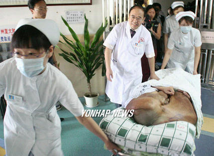 China Elephant Man (AP)