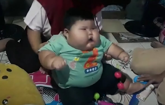 몸무게 27kg, 기저귀도 'XXXL 사이즈'…생후 16개월 아기의 사연