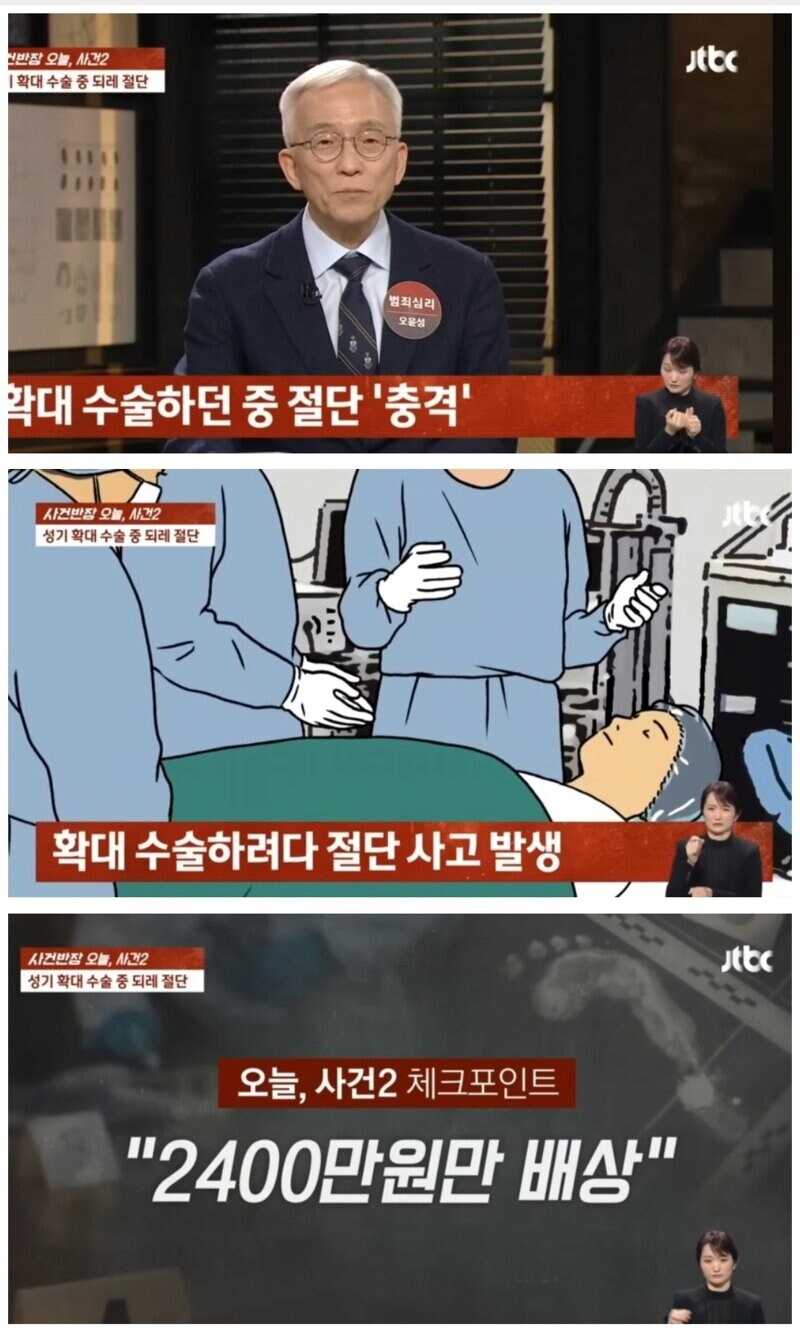 남자 고추 가격