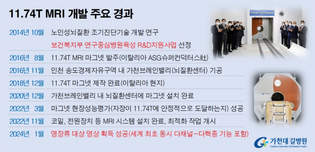 치매 유발 단백질, 3개만 쌓여도 MRI에 딱 보인다