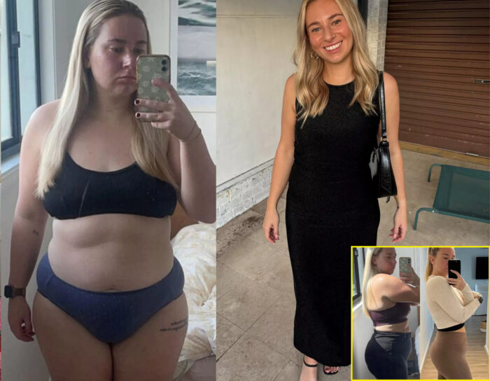 살쪘던 원인이 '이 병?'...27kg 빼고 병도 나아져, 살 뺀 비결 보니