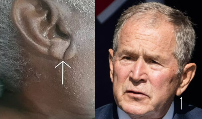 "귓불에 '이 주름' 생겼다면"...심장에 이상 있다는 신호?