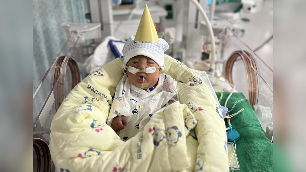 국내에서 가장 작게 태어난 쌍둥이 형제 1명 퇴원