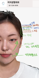 [AI TECH+ 2024] 글래드파크, 뷰티의료용 3D솔루션 'EZ-FACE' 개발