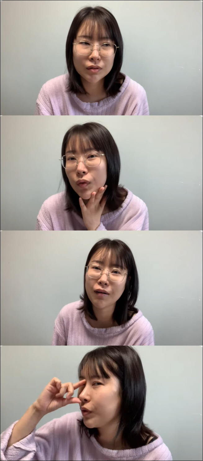 이세영 가슴 성형 부작용에도 전남친 결혼식 참석 얼굴 바뀌었지만 알아볼 것