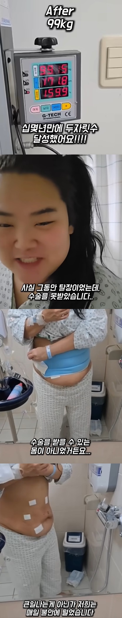 미나 시누이, 150kg→99kg 달성 후 수술 "탈장으로 응급실…올해 새 삶 살겠다" (필미커플)