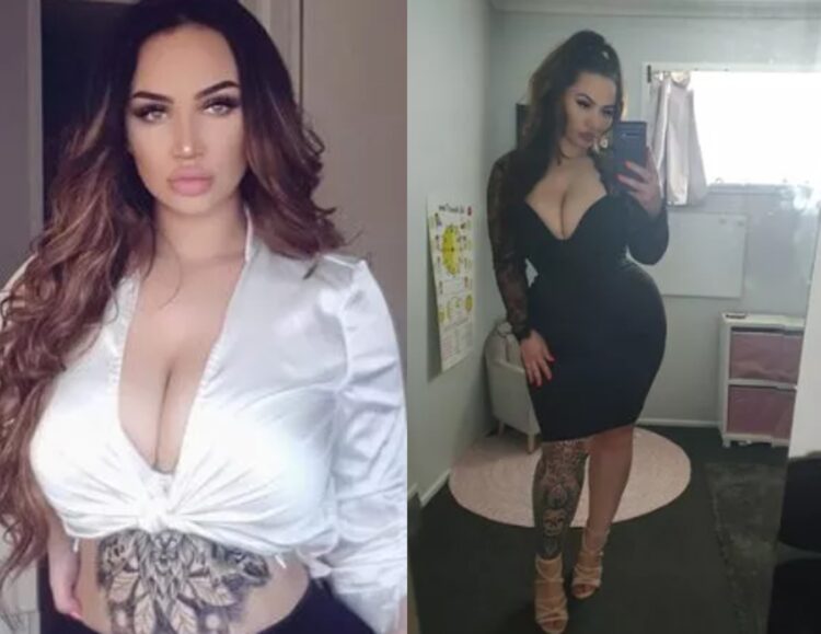 "유방 계속 커져 P컵 됐다"...가슴둘레만 143cm女 '이 병' 때문, 뭐길래?