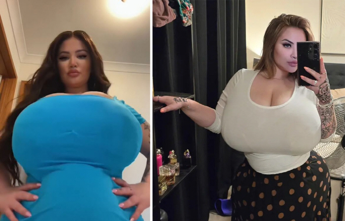 “가슴이 계속 커져요”…‘P컵’ 가슴 덕에 ‘연 5억’ 버는 20대女의 하소연