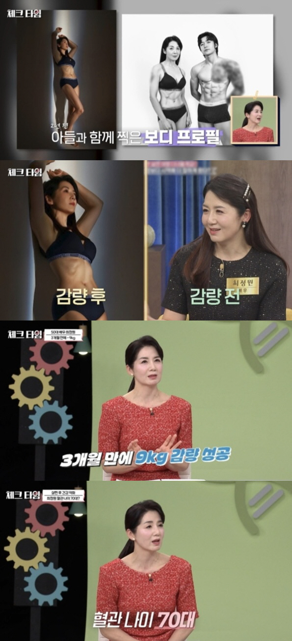 '54세' 최정원, 9kg 급감 이유 고백 "온몸이 염증 덩어리" ('체크타임')