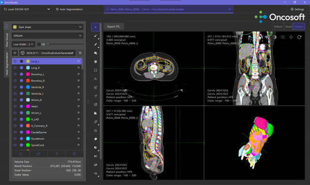 Qt 그룹, 온코소프트의 AI 의료영상 분석 소프트웨어 ‘OncoStudio 2.0’에 개발 플랫폼 지원
