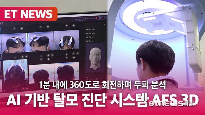 [WIS 2025] 'AI가 탈모도 분석해준다?' 탈모 진단 시스템 'AFS 3D' [영상]