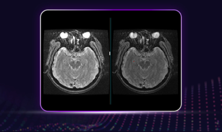 벌써 6번째…제이엘케이, MRI 기반 AI 솔루션 'JLK-GRE' 日 허가 획득