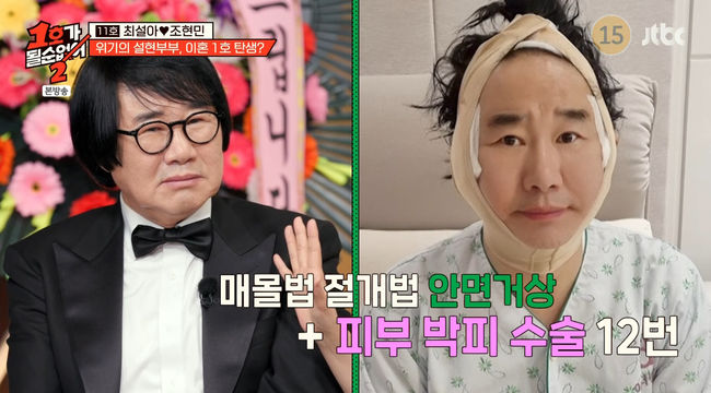 최양락, 성형 중독자 됐다 "안면거상 36바늘·입꼬리 수술에 박피도 12번" ('1호가 될 순 없어2') [핫피플]