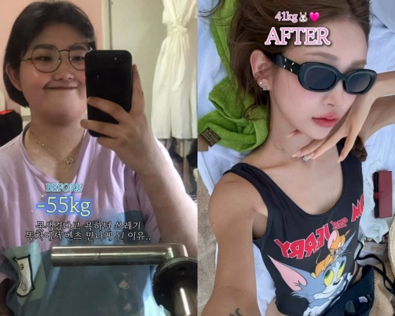 '96kg→41kg' 최준희 "눈바디 맛집" CG 의심케 하는 다리 보니