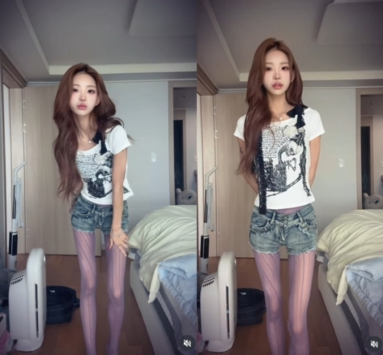 '96kg→41kg' 최준희 "제일 잘생긴 내몸" 부러질 듯한 다리