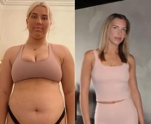 “살쪄서 ‘이 병’ 걸렸어요”… 살기 위해 45kg 감량한 여성, 방법은?