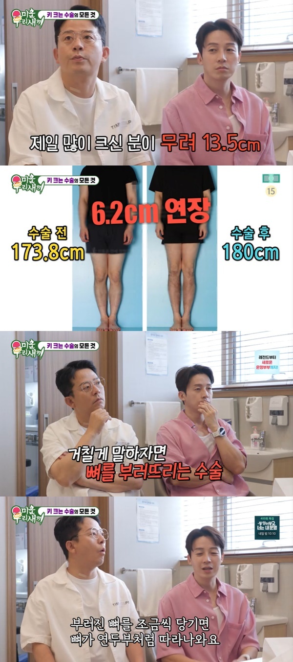“최소 4천만 원” 168㎝ 허경환 김준호, 사지 연장술 상담 ‘진지’ (미우새)[어제TV]