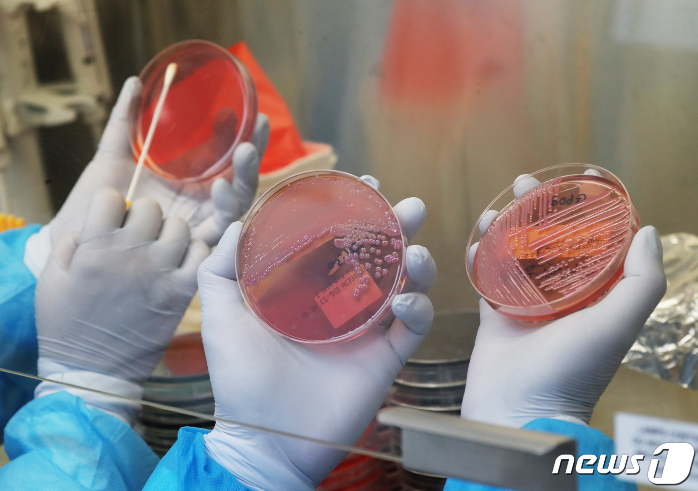 일주일 새 노로바이러스 환자 548명 발생…5년 내 최대