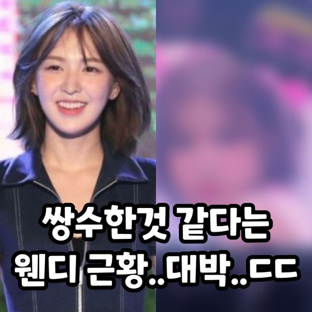 연예거중기 쌍수한것 같다는 레드벨벳 웬디 근황 Daum 카페