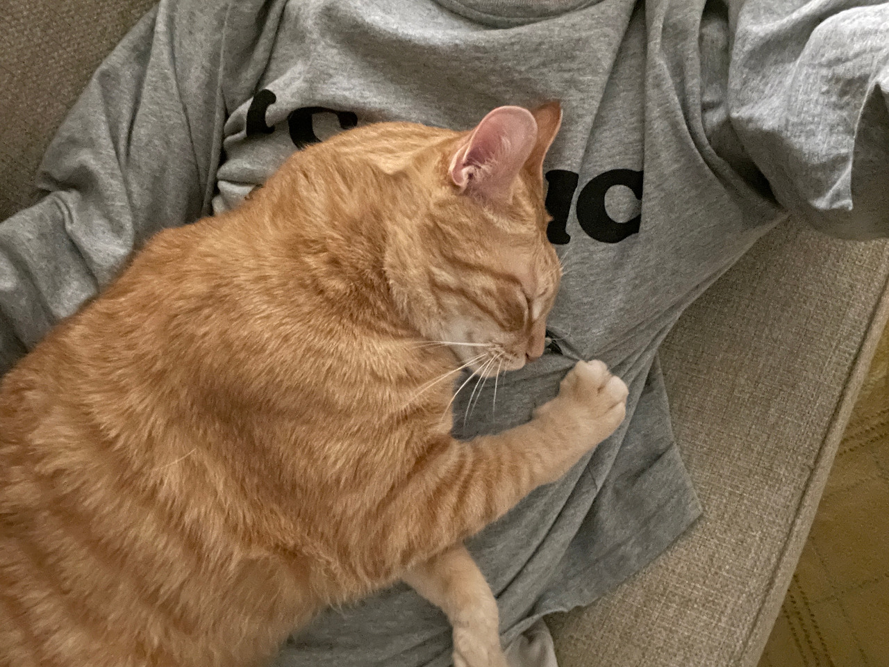 인공수정체 탈구 공막고정술,3박4일 입원기