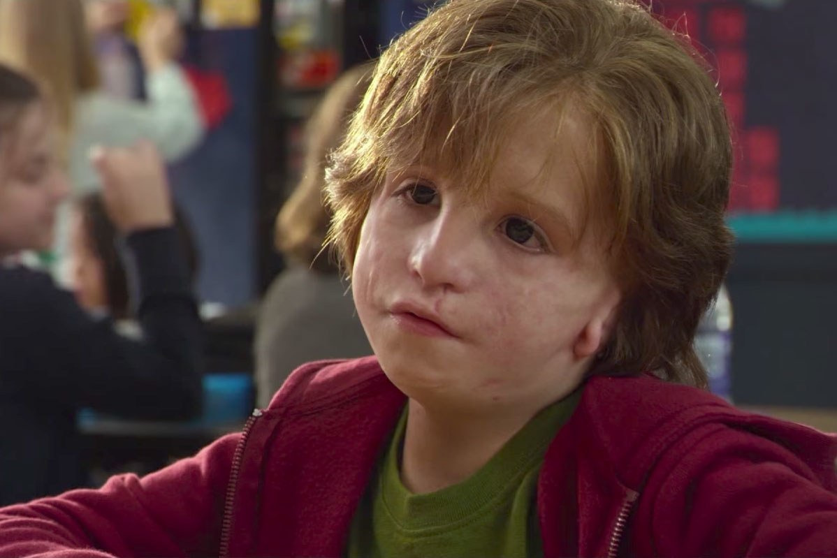 포근한 영화, 원더