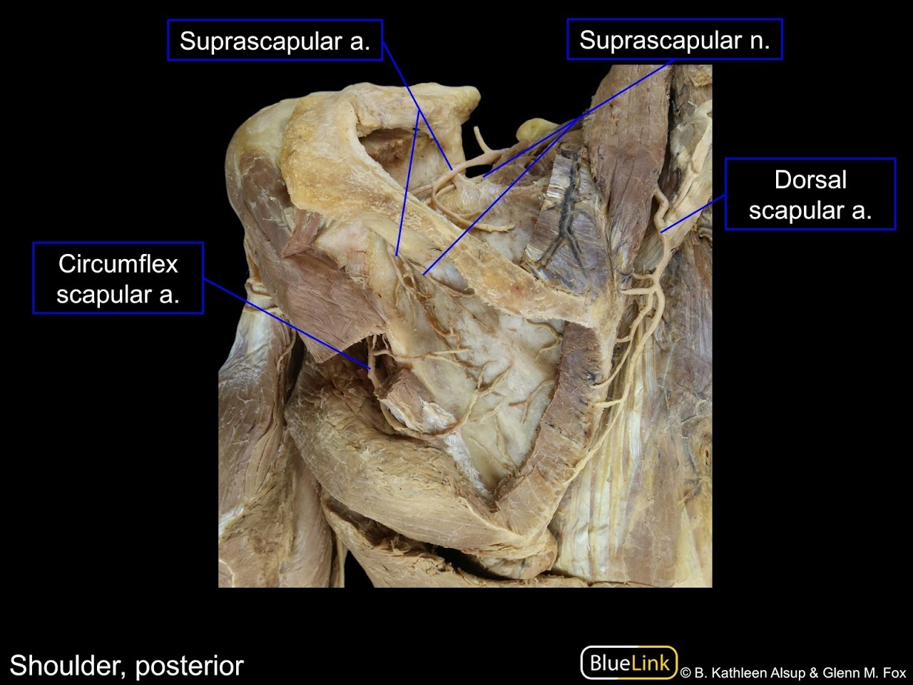 상완신경총(The Brachial Plexus)