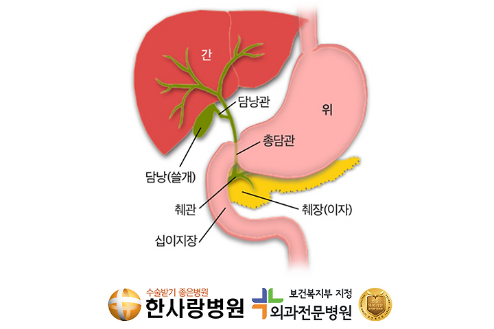 Top 64 담낭용종 Update